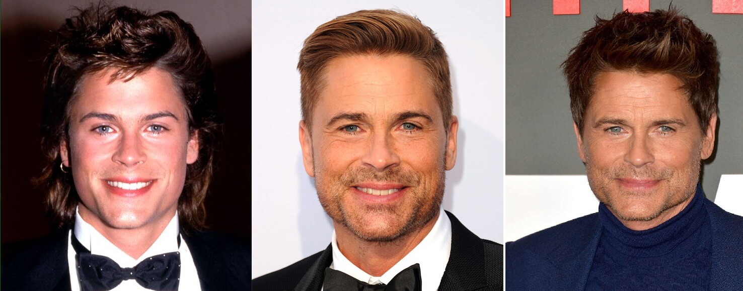 Rob Lowe Hair Transplant & Hair Loss