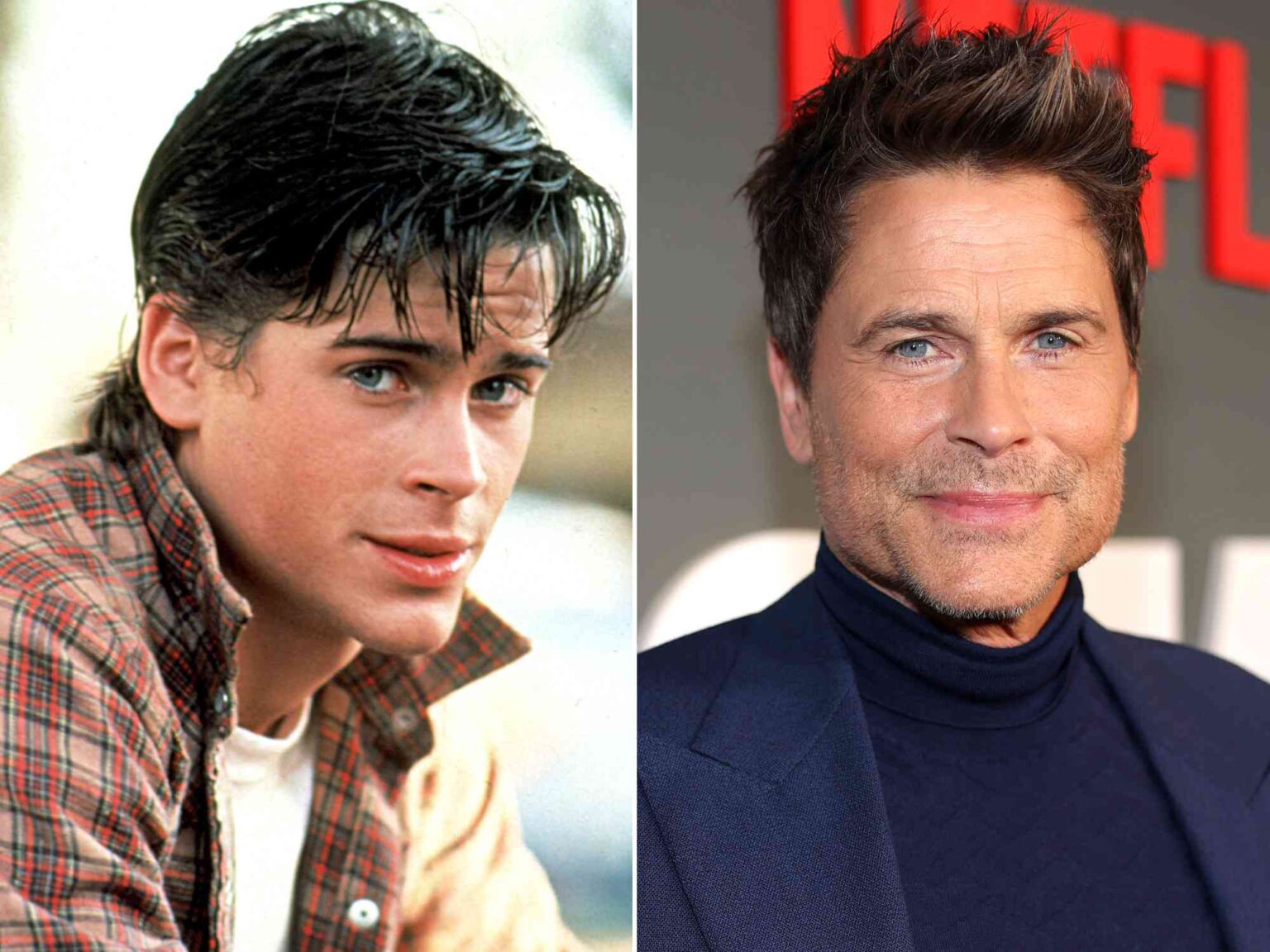 Trasplante de cabello y pérdida del cabello de Rob Lowe - Erdem ...