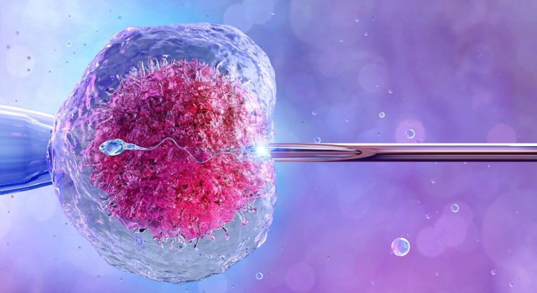 Viaggio in Turchia per fecondazione in vitro?-Erdem Hospital
