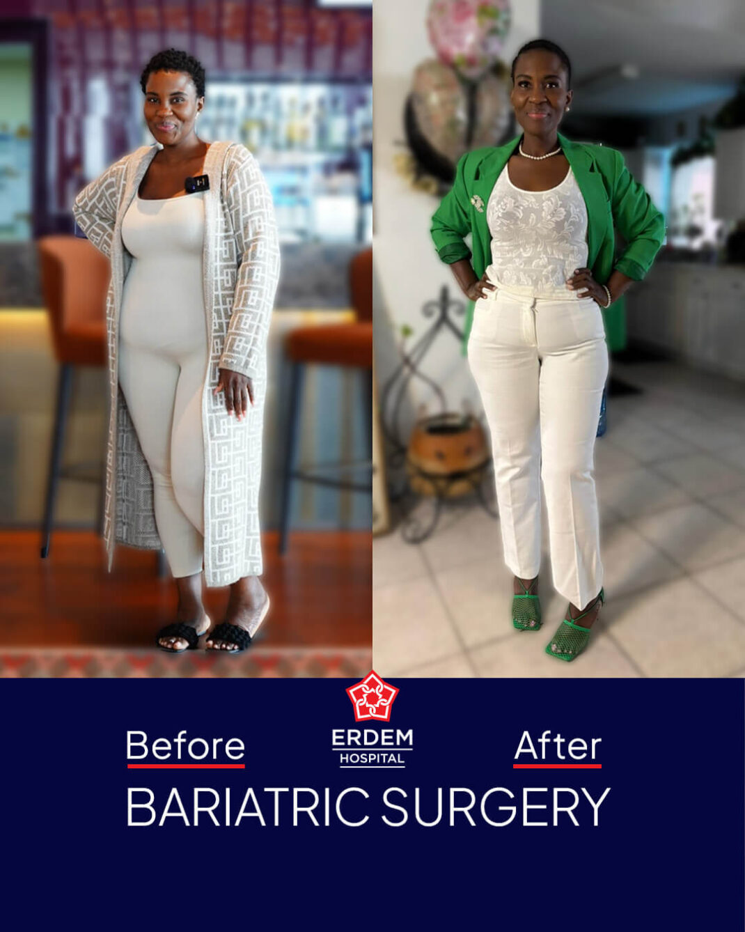 Gastric Sleeve in Turkey | Erdem Hospital