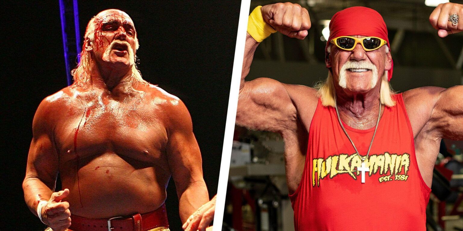 Hulk Hogan Aesthetic Procedures He Reportedly Had